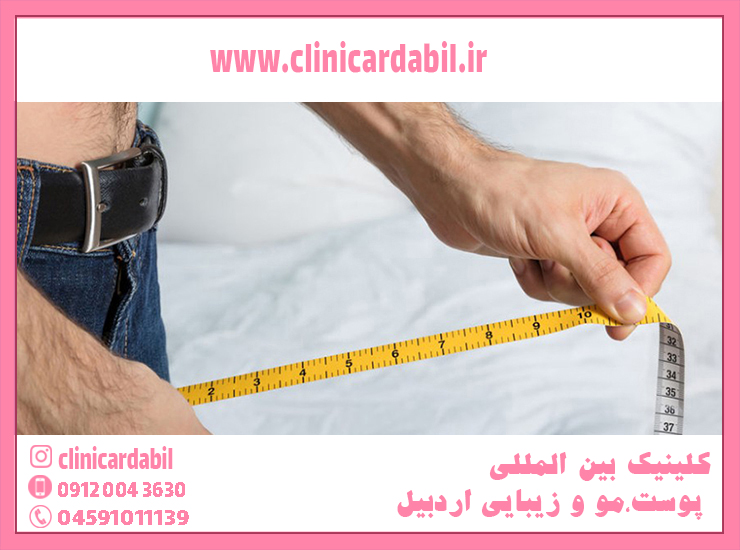 روش های بزرگ کردن آلت تناسلی مردان چیست؟ کلینیک بین المللی پوست و مو